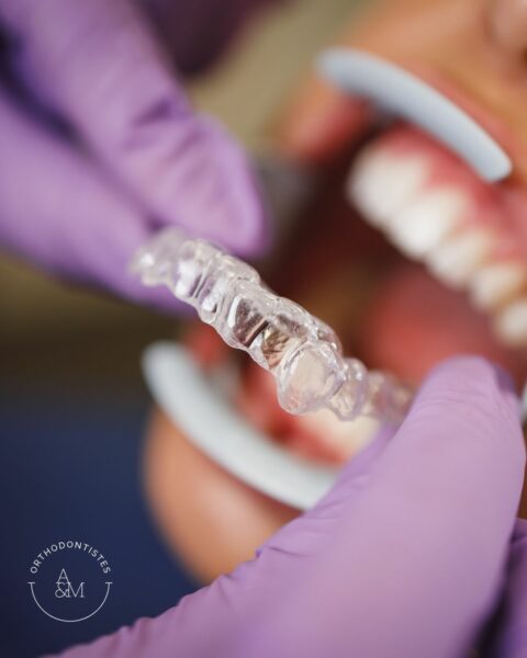 Invisalign: advantages and limits of invisible orthodontics - Archambault Morton Orthodontiste